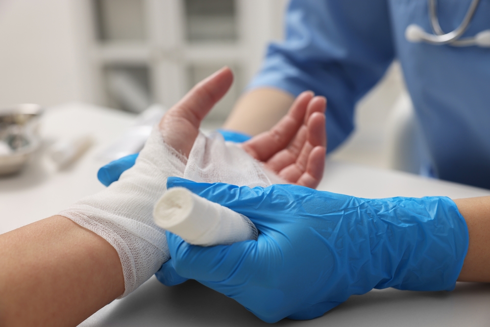 Burn Injuries — Buffalo Personal Injury Lawyer News — June 10, 2025